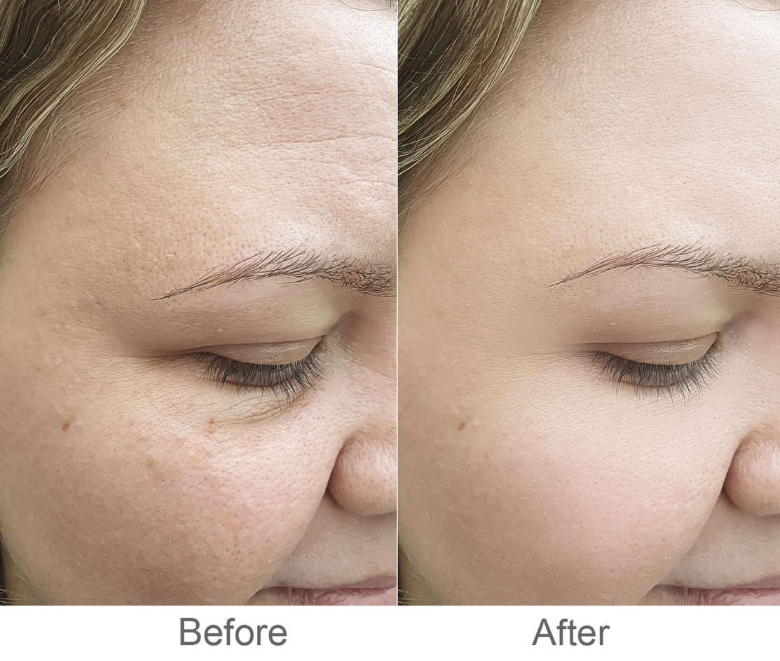 Beauty Services Hills District: Kellyville, Castle Hill, Rouse Hill ...